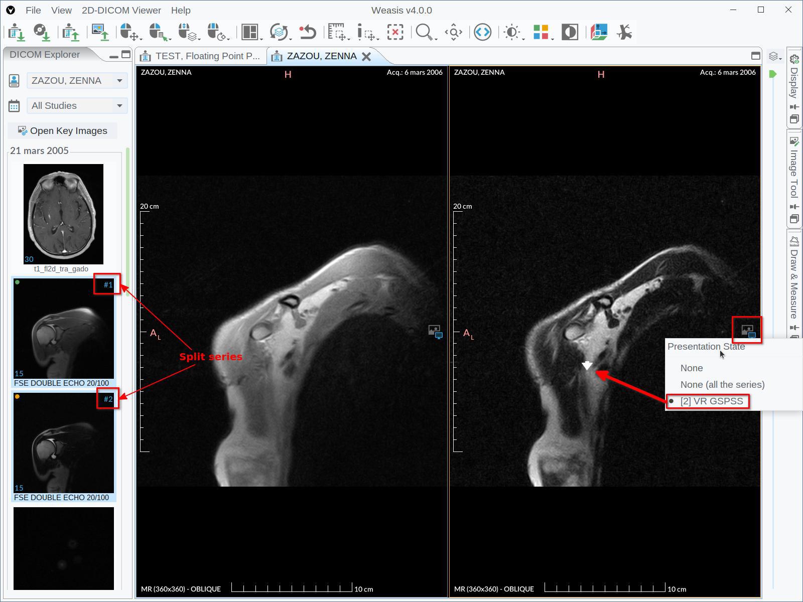 Weasis: Free DICOM viewer :: Weasis Documentation